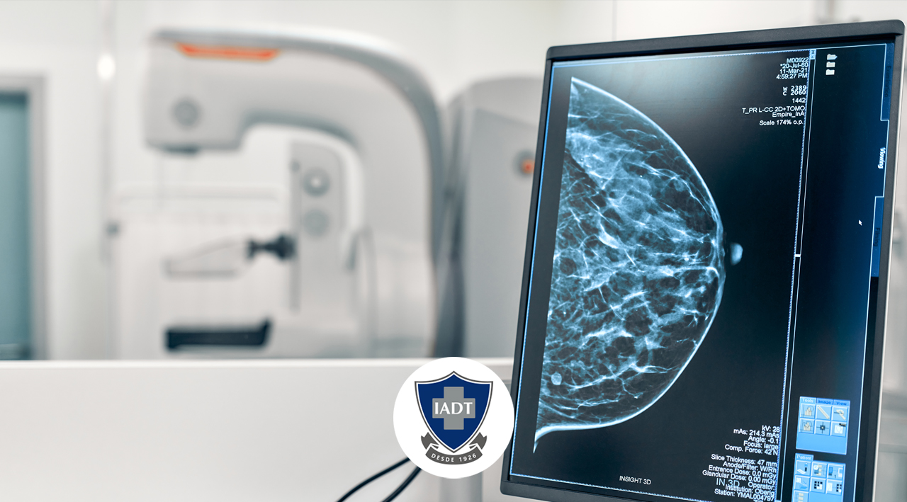 Mamografía | Prevención y diagnóstico de cáncer de mama - IADT